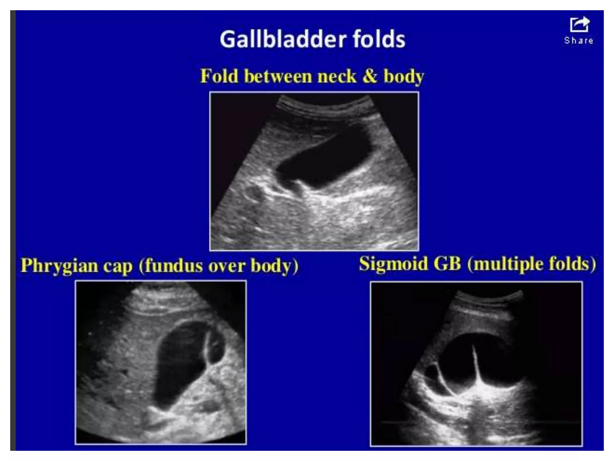 Biliary tract imaging final........... | PPTX