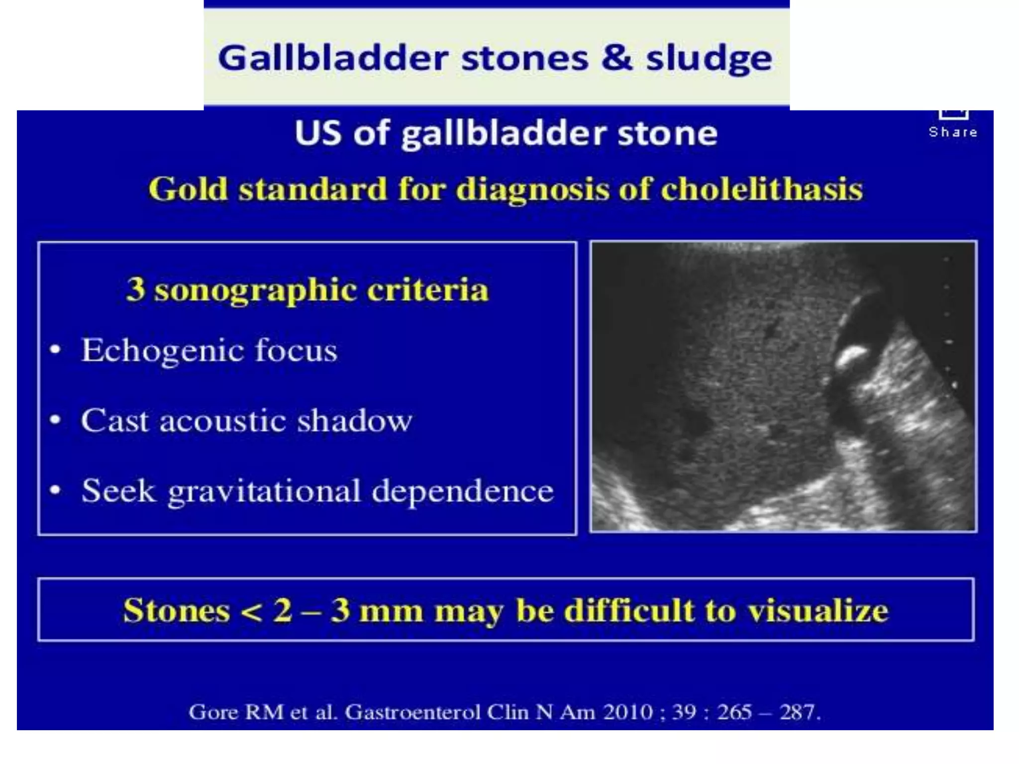 Biliary tract imaging final........... | PPTX