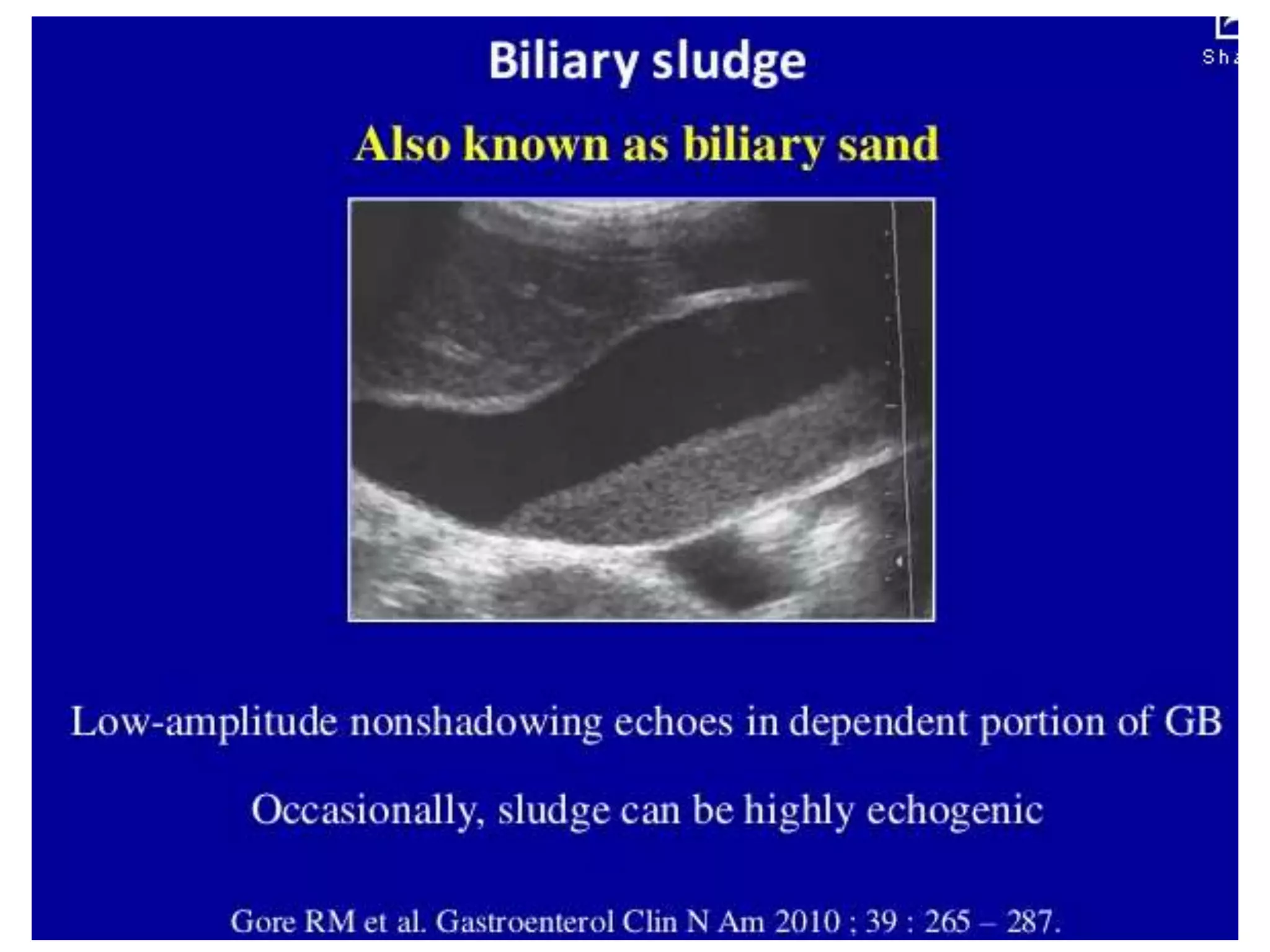 Biliary tract imaging final........... | PPTX