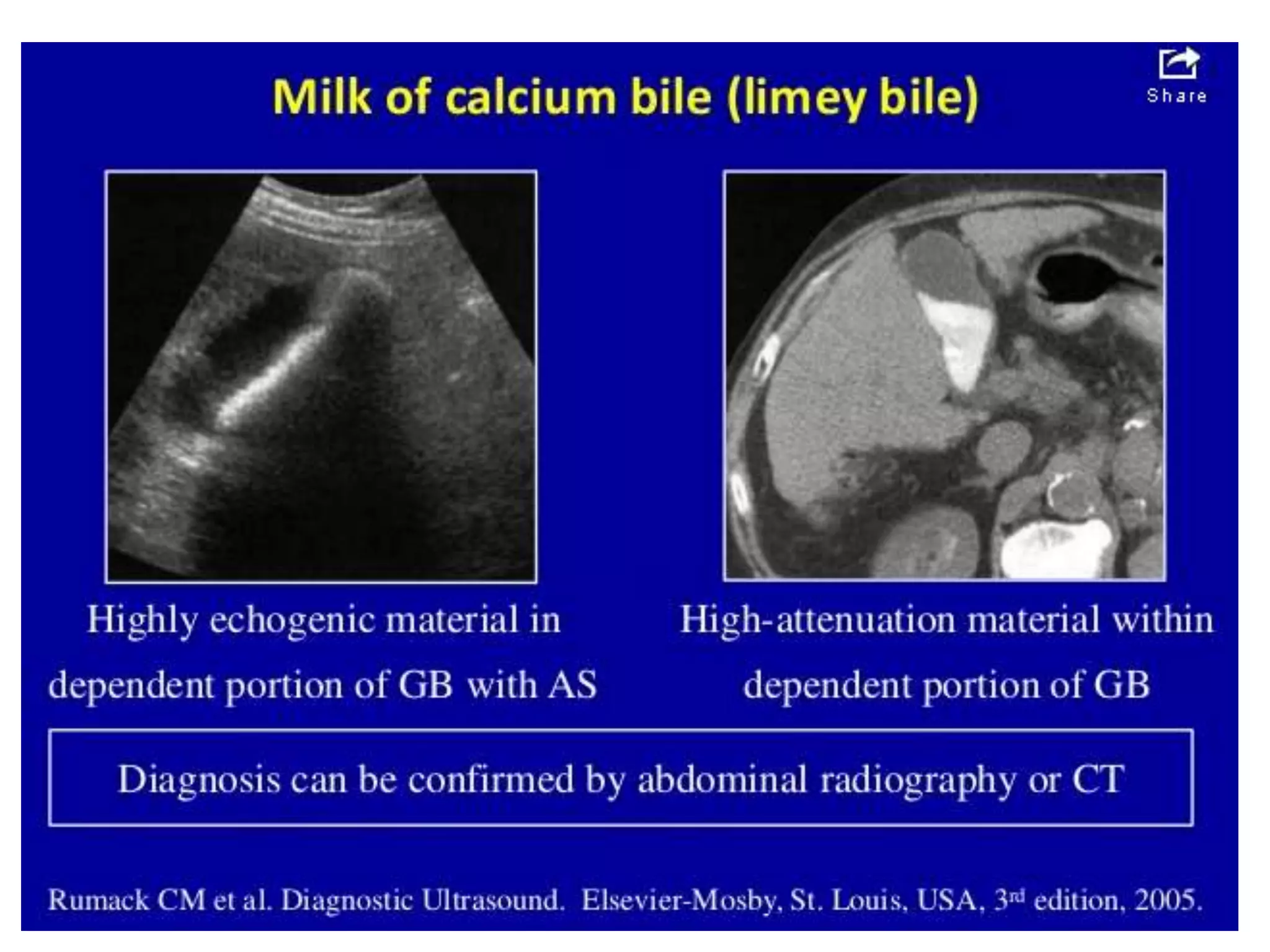 Biliary tract imaging final........... | PPTX