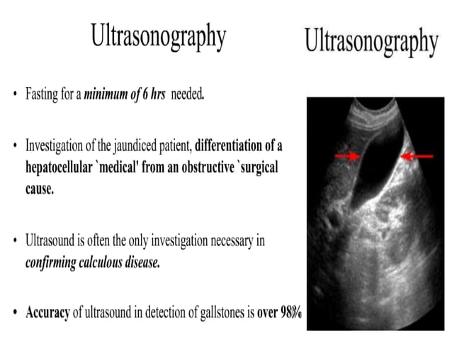 Biliary tract imaging final........... | PPTX | Digestive Disorders | Diseases and Conditions