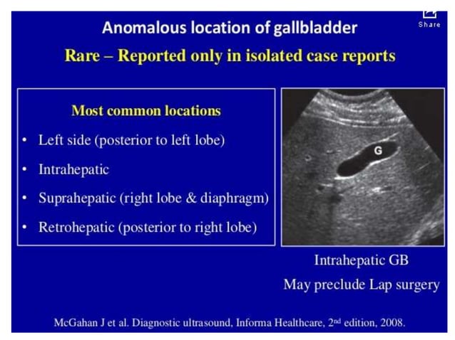 Biliary tract imaging final........... | PPTX | Digestive Disorders ...