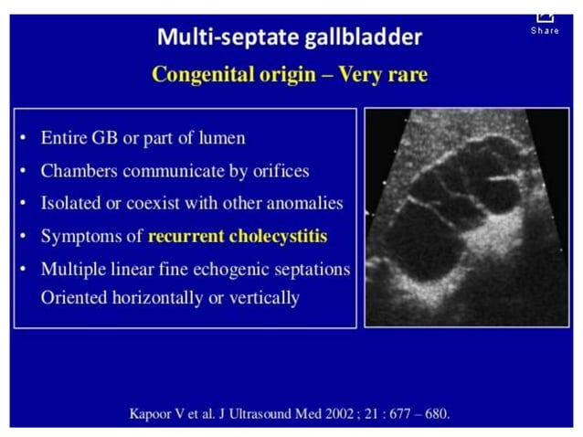 Biliary tract imaging final........... | PPTX | Digestive Disorders ...