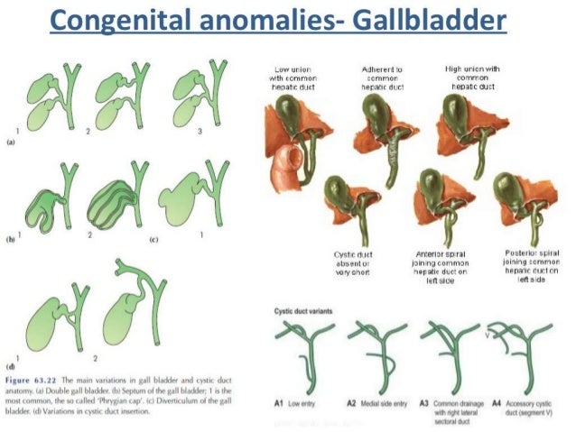 Biliary tract imaging final...........