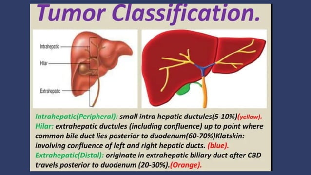 Biliary Tract Tumours(Cholangiocarcinoma,Cystadenoma/cystadenocarcinoma ...