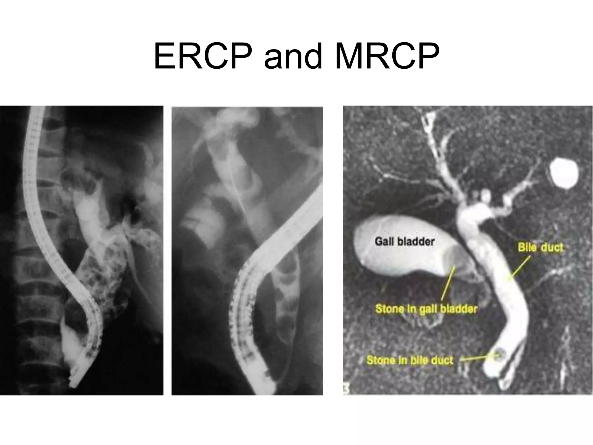 biliary_tree_lecture.ppt