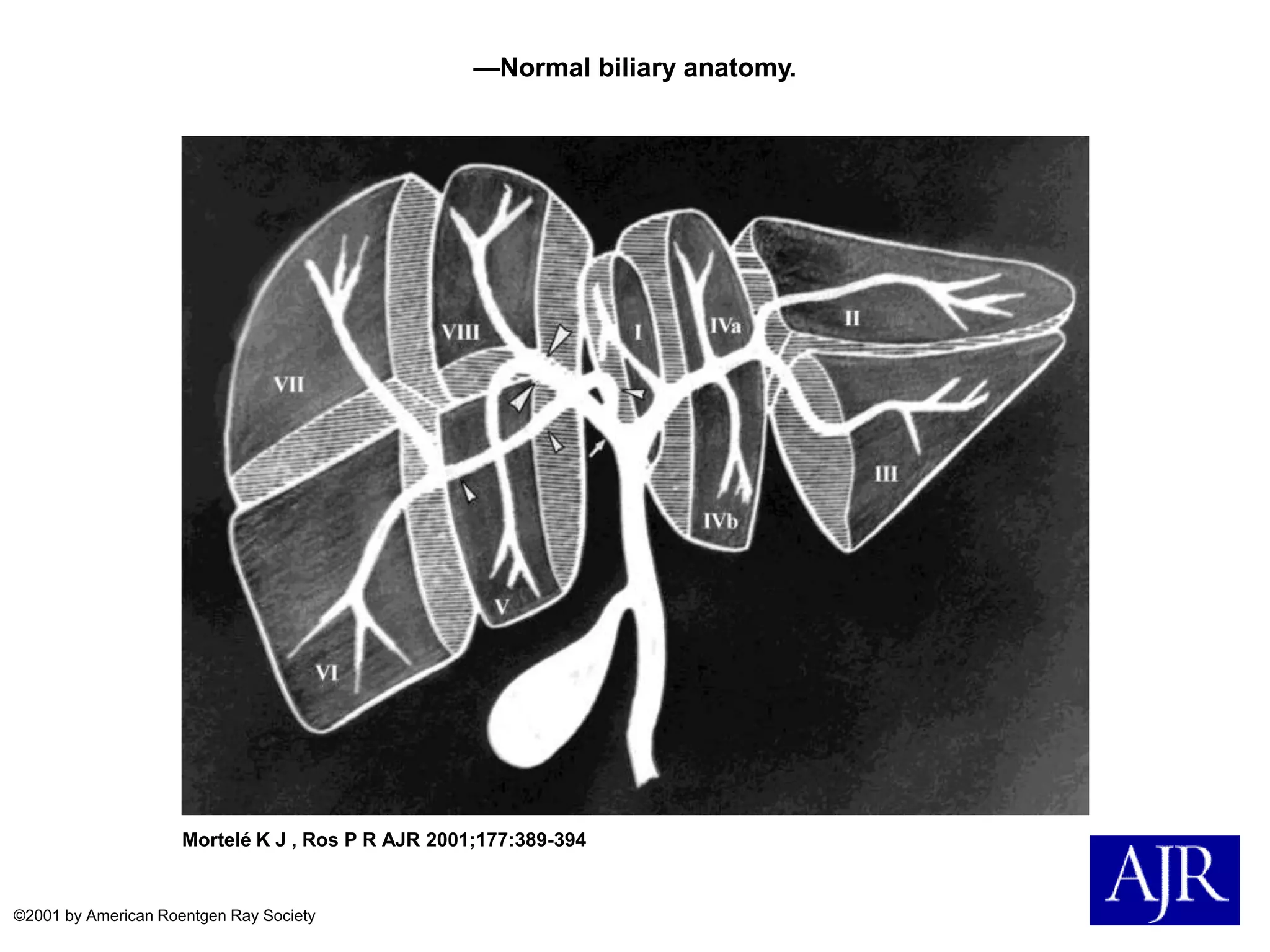 biliary_tree_lecture.ppt