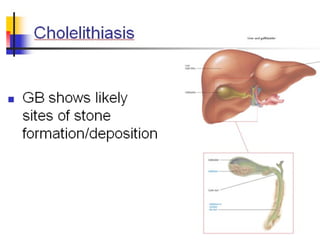 Comprehensive Overview of Biliary Tree Anatomy, Diseases, and ...