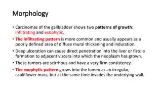 Biliary Tumors.pptx | Free Download