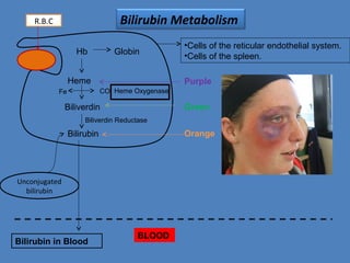Bilirubin | PPT