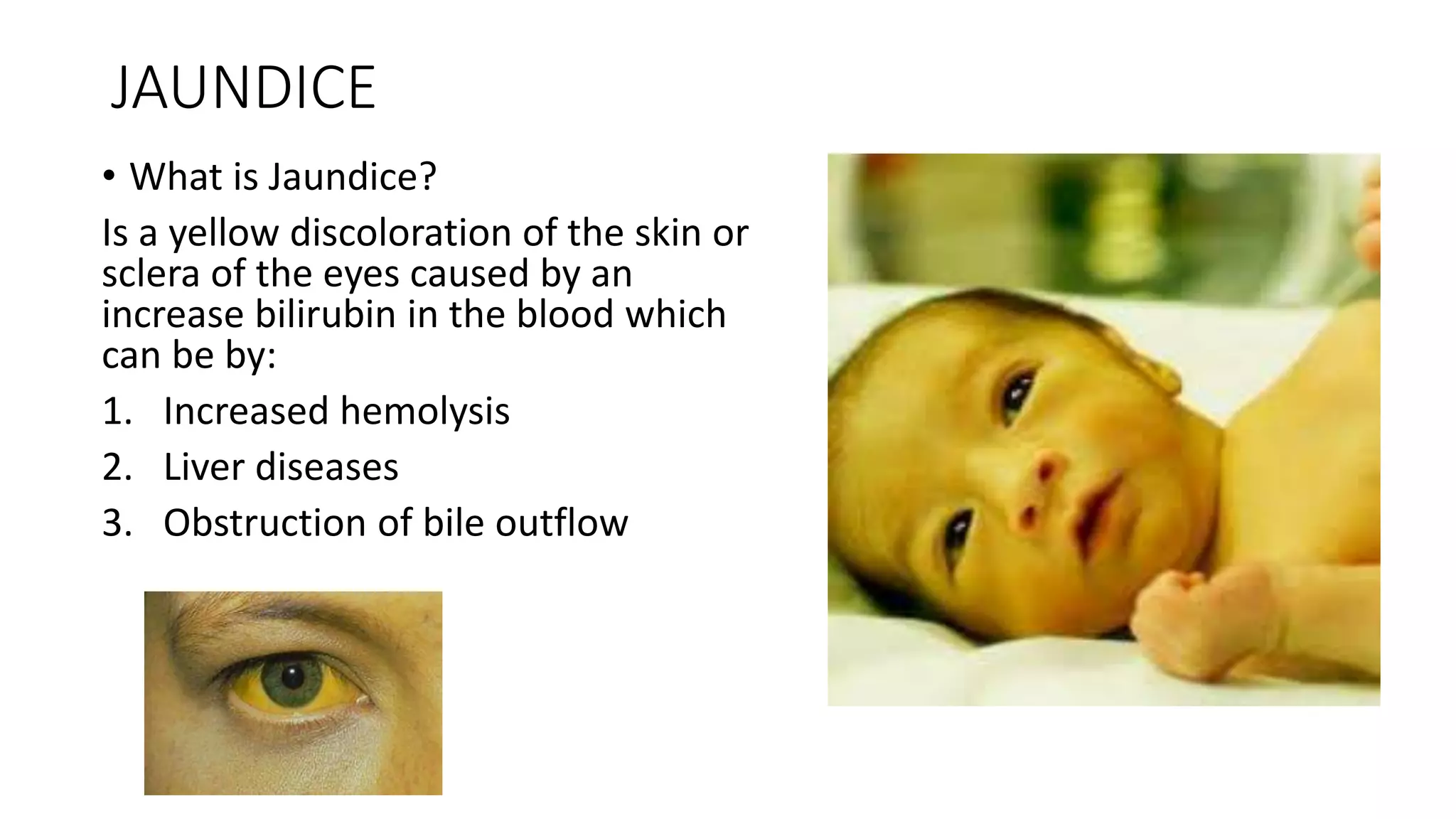 BILIRUBIN METABOLISM AND JAUNDICE(0).pptx