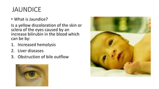 BILIRUBIN METABOLISM AND JAUNDICE(0).pptx