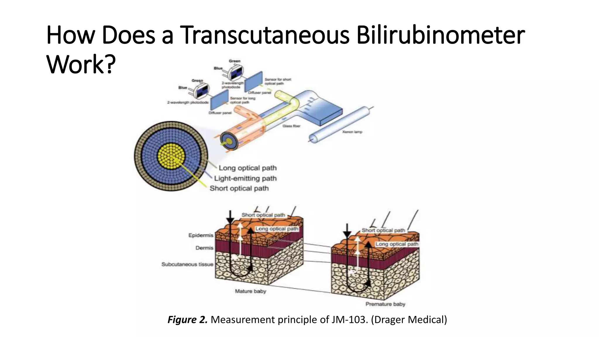 Bilirubinmeter | PPTX