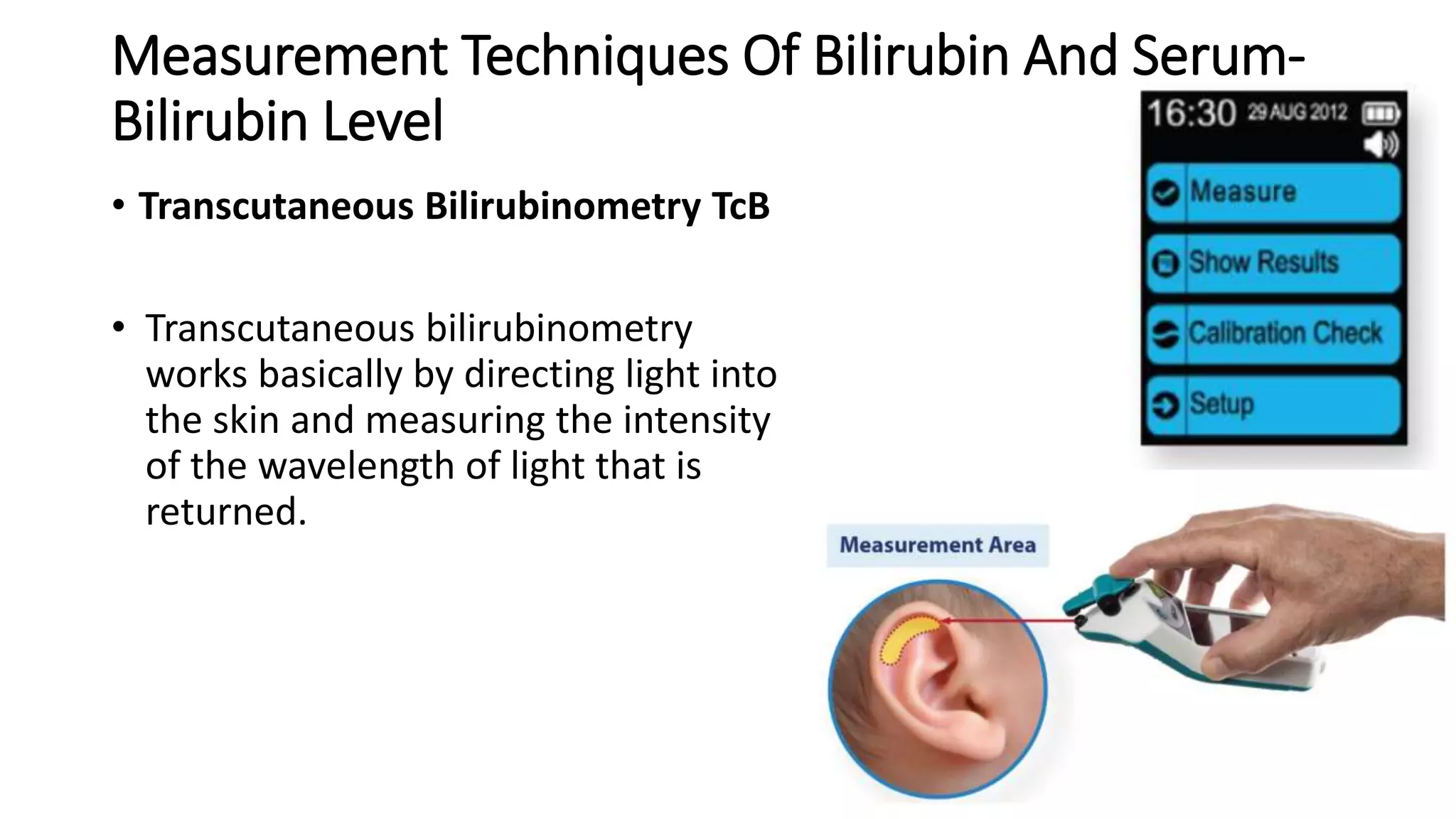 Bilirubinmeter | PPTX