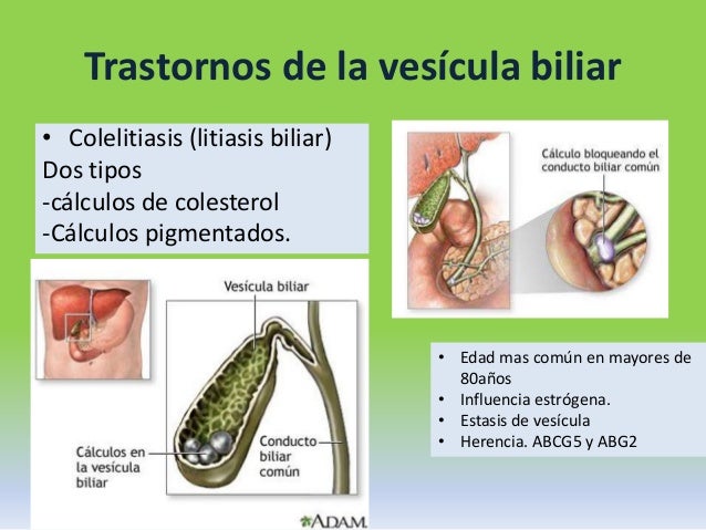 Enfermedades De La Vesicula Biliar Y Conductos Biliares Ciencia Y Images Enfermedades De La Vesicula Biliar Y Conductos Biliares Ciencia Y Images