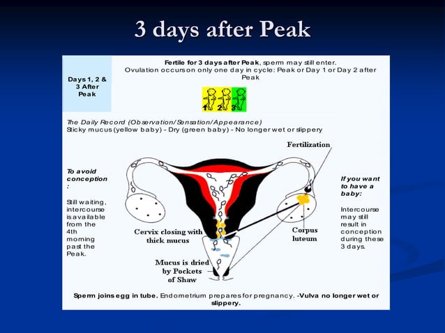 Billings Ovulation Method.ppt