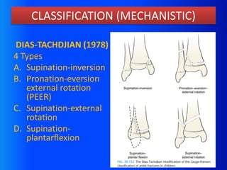 Bimalleolar fracture.pptx