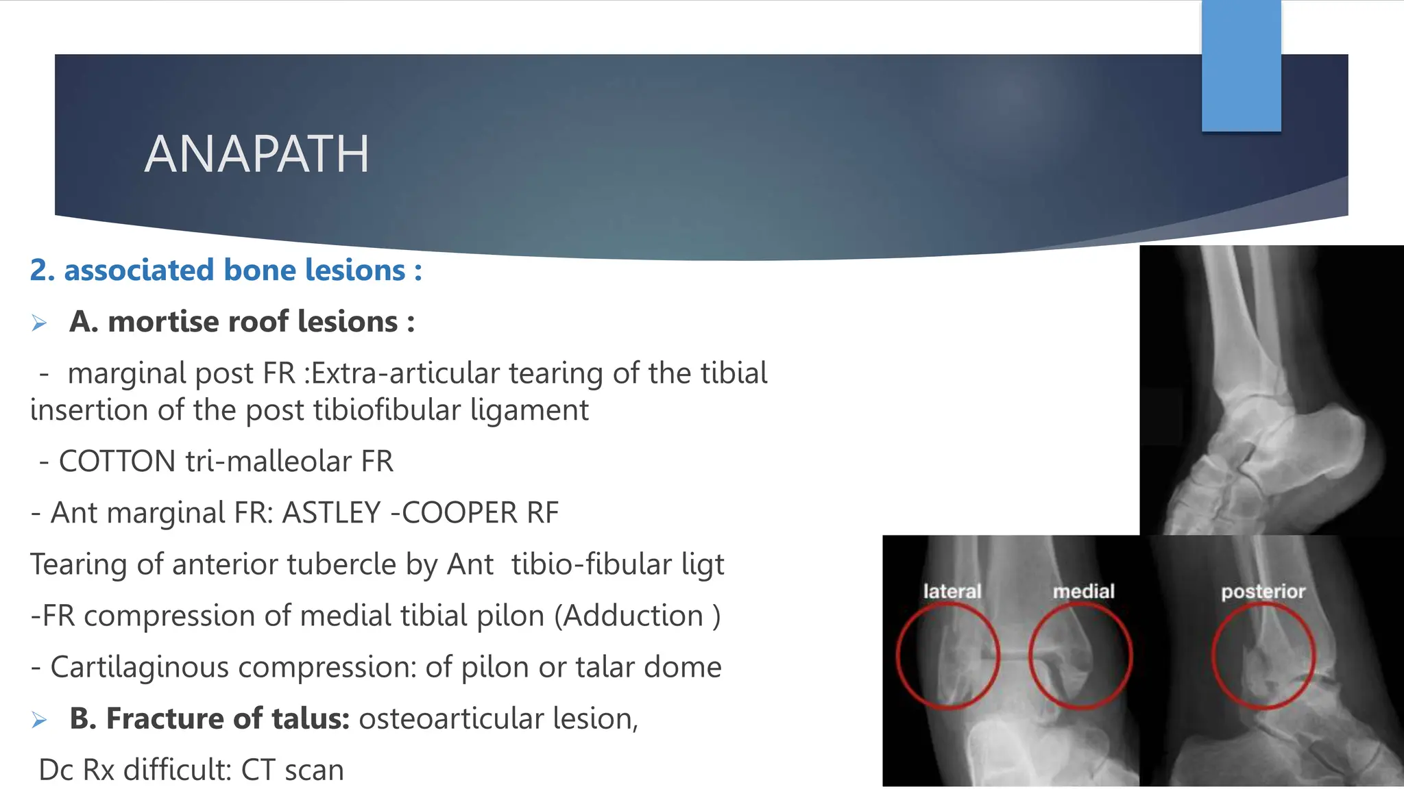 BIMALLEOLAR FRACTURES mechanism and anapath.pptx