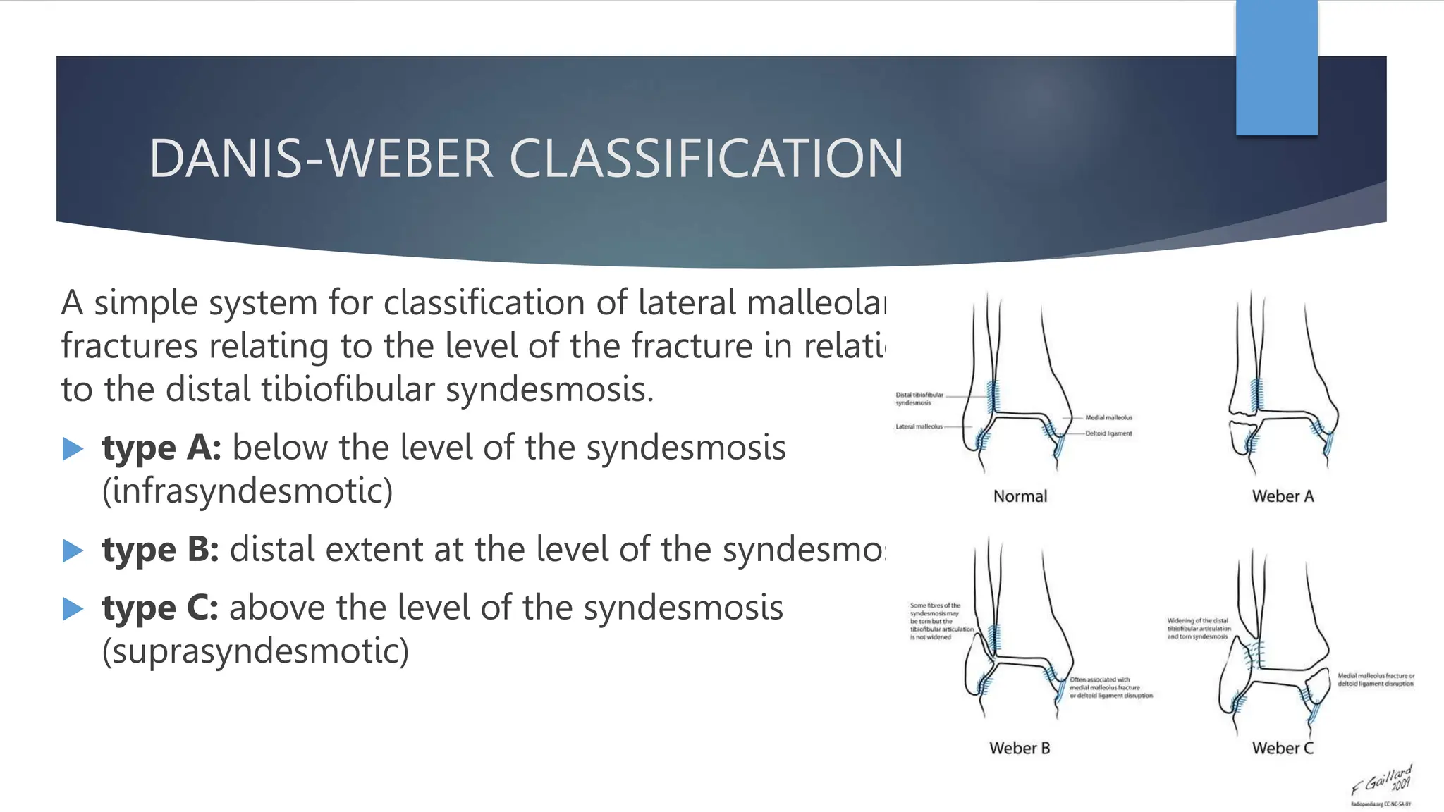 BIMALLEOLAR FRACTURES mechanism and anapath.pptx