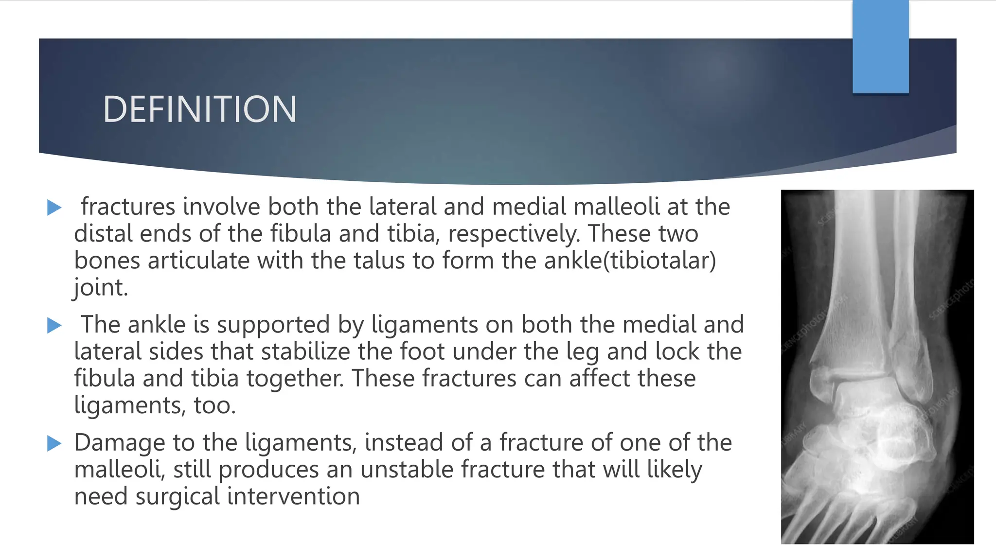 BIMALLEOLAR FRACTURES mechanism and anapath.pptx