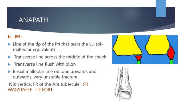 BIMALLEOLAR FRACTURES mechanism and anapath.pptx | Death, Injury, or ...