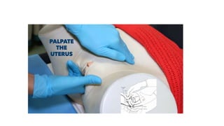 Bimanual examination.pptx