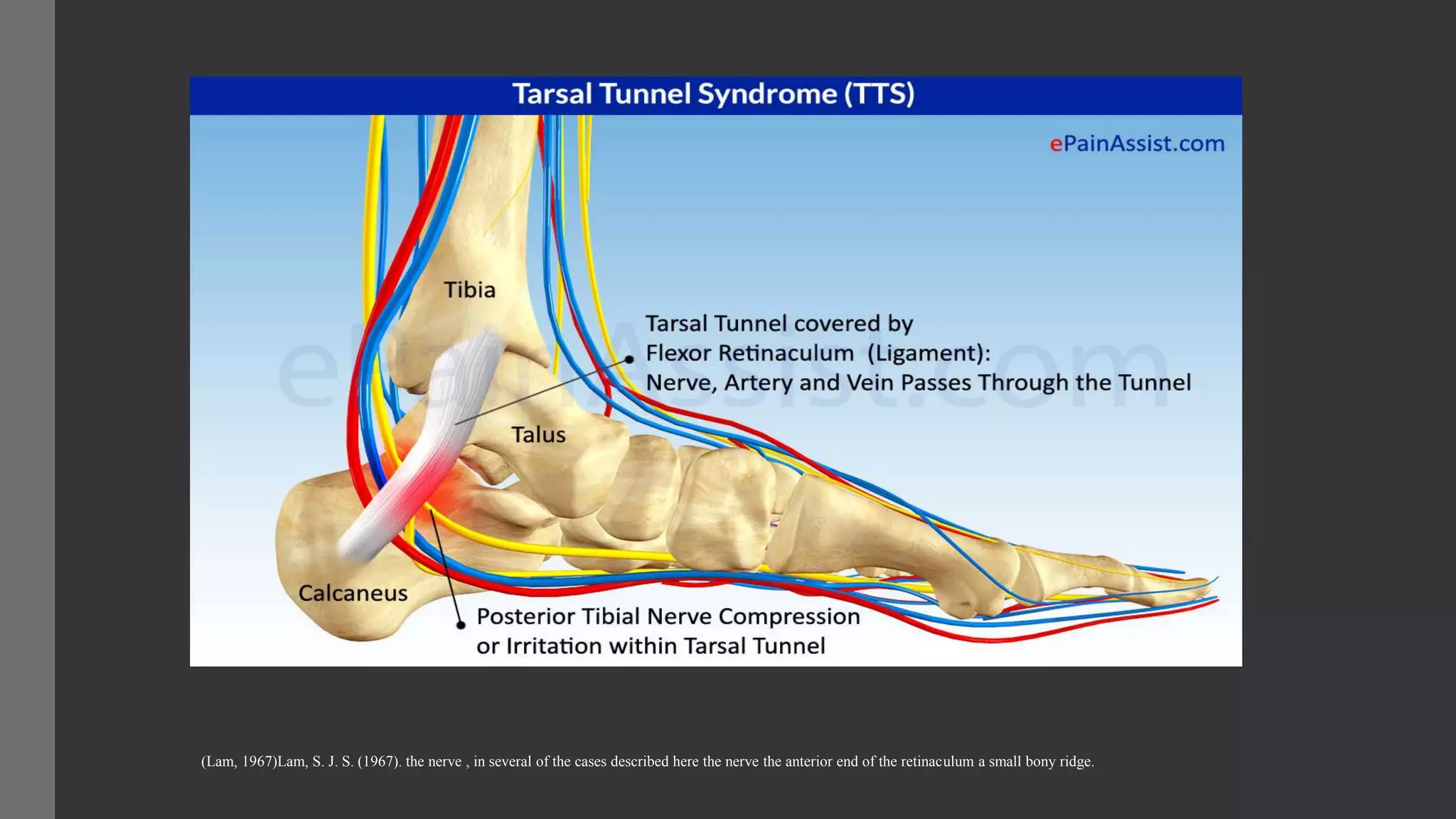 BIMBINGAN 7 - CTS, TTS, Neuropati, Peroneal Palsy, Neurogenic Bladder ...
