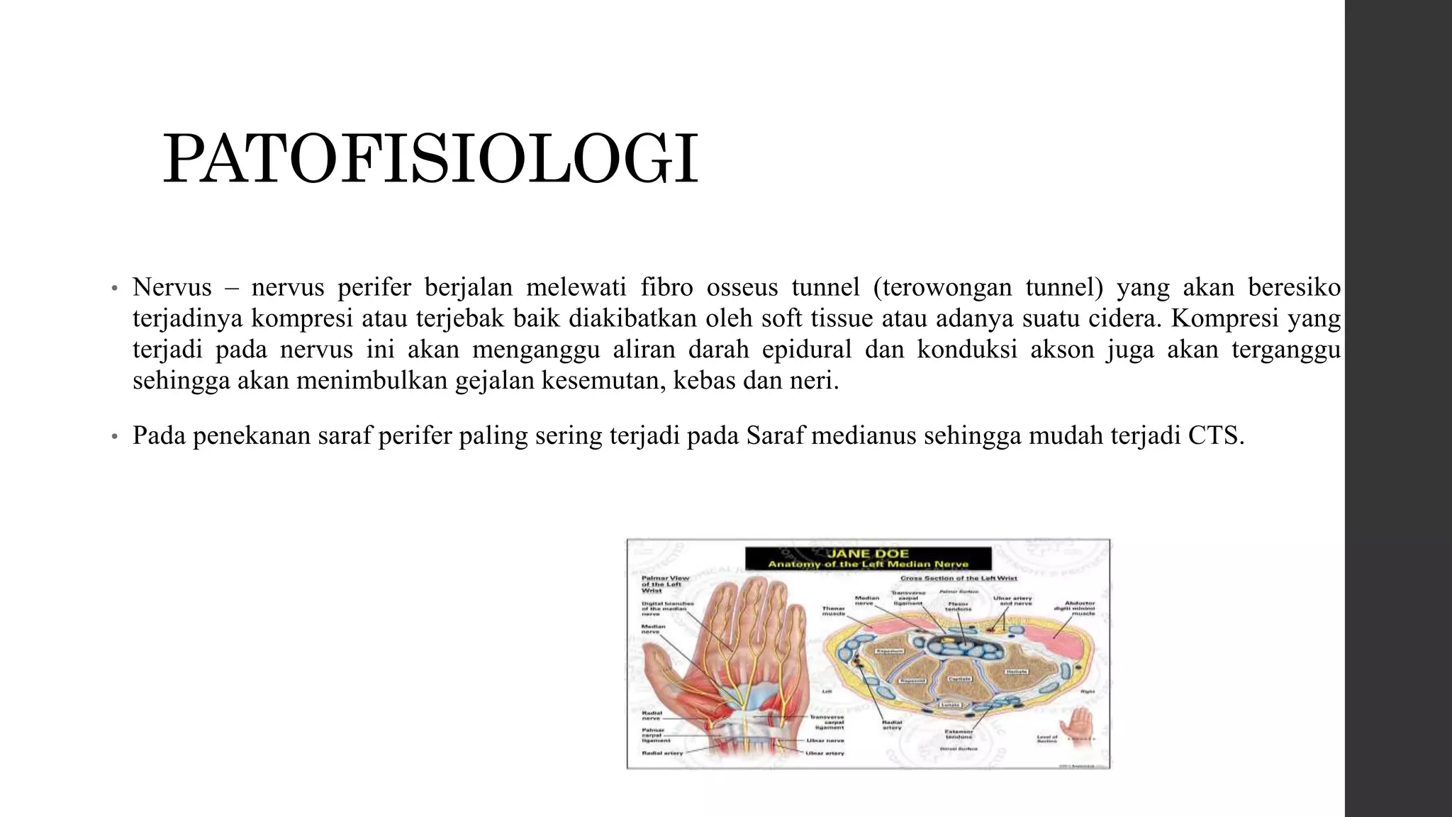 BIMBINGAN 7 - CTS, TTS, Neuropati, Peroneal Palsy, Neurogenic Bladder ...