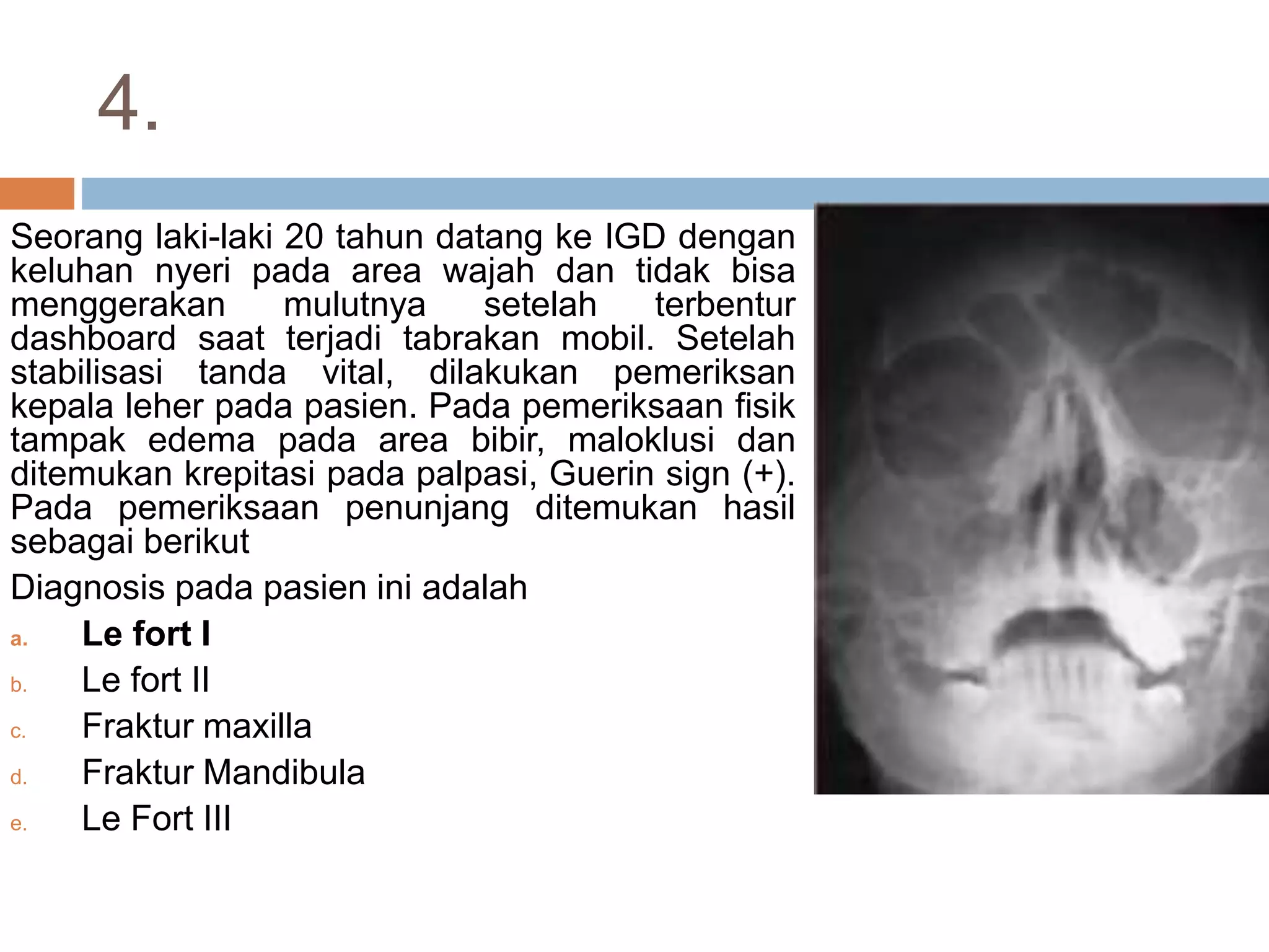 Bimbingan Radiologi I.pptx