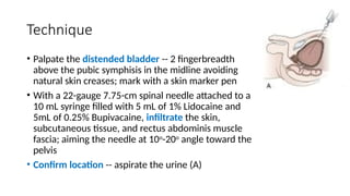 Bimbingan Sistostomi Terbuka Bedah—-Umum | PPTX
