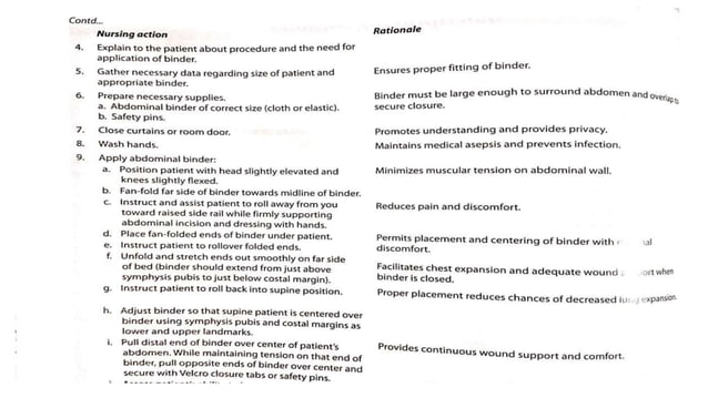 Binder and splint ppt | PPTX