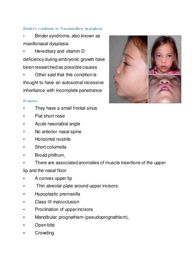 Binder Syndrome Signs And Symptoms at Maria Cardenas blog