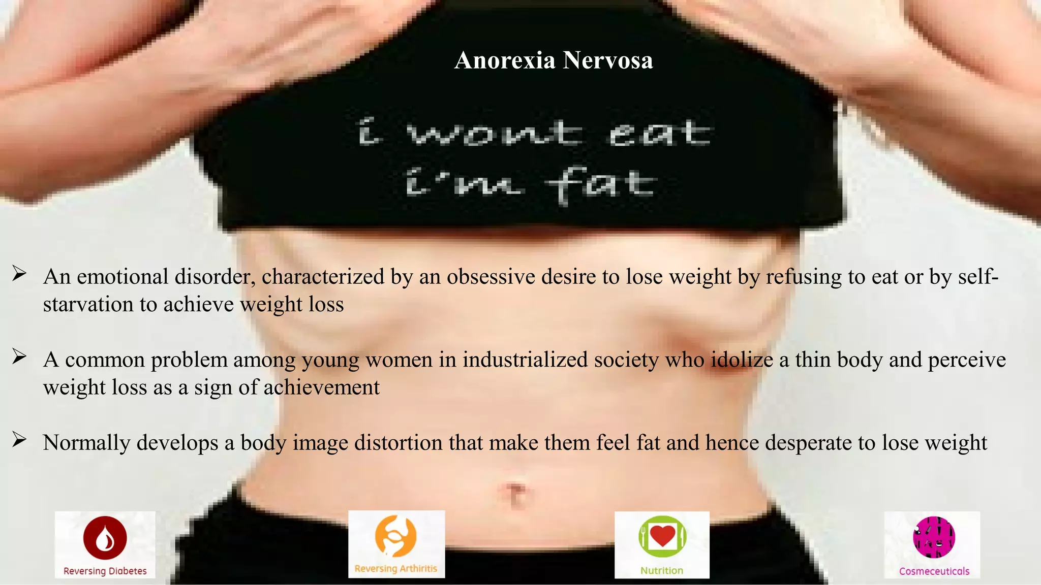 Binge Eating - A psychological disorder | PPT