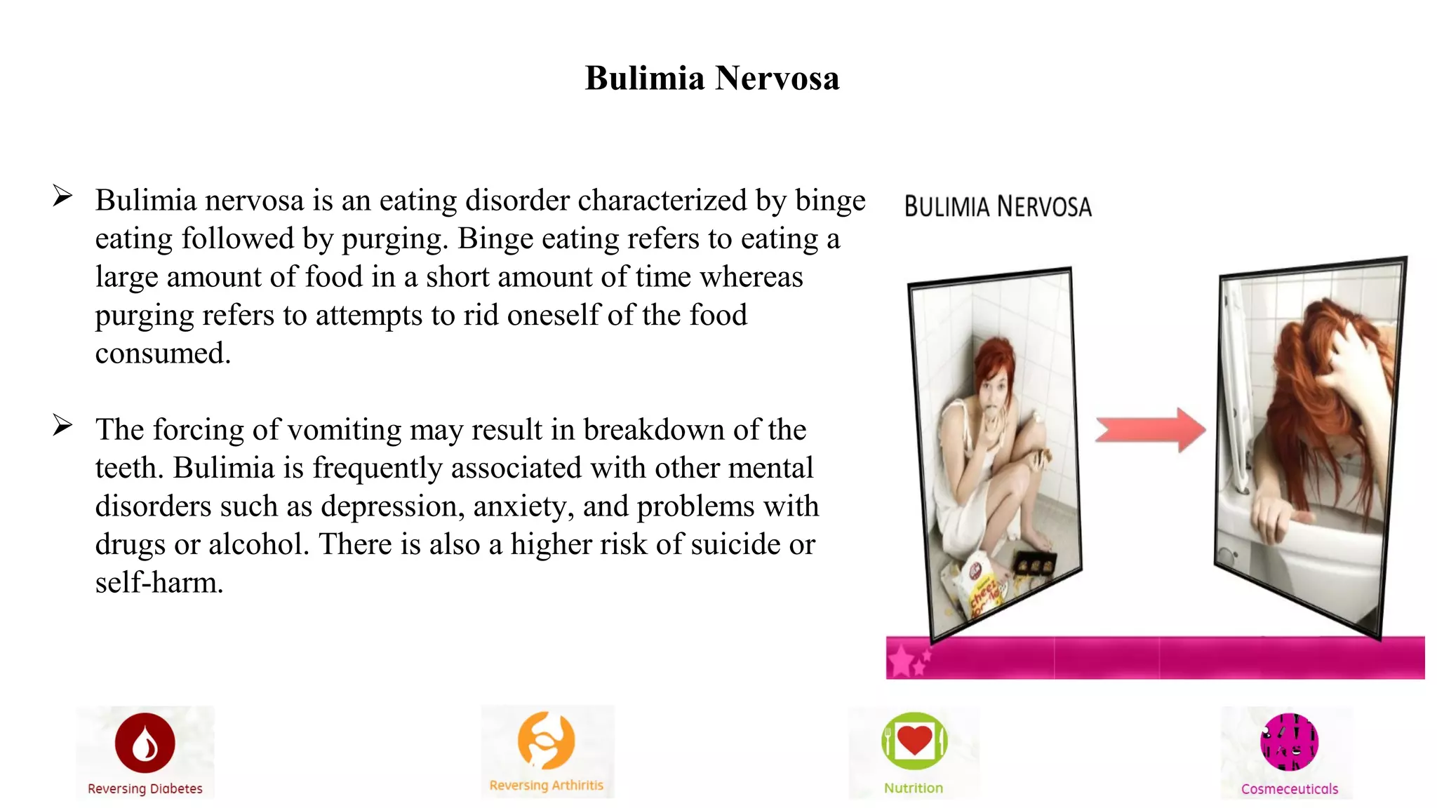 Binge Eating - A psychological disorder | PPT