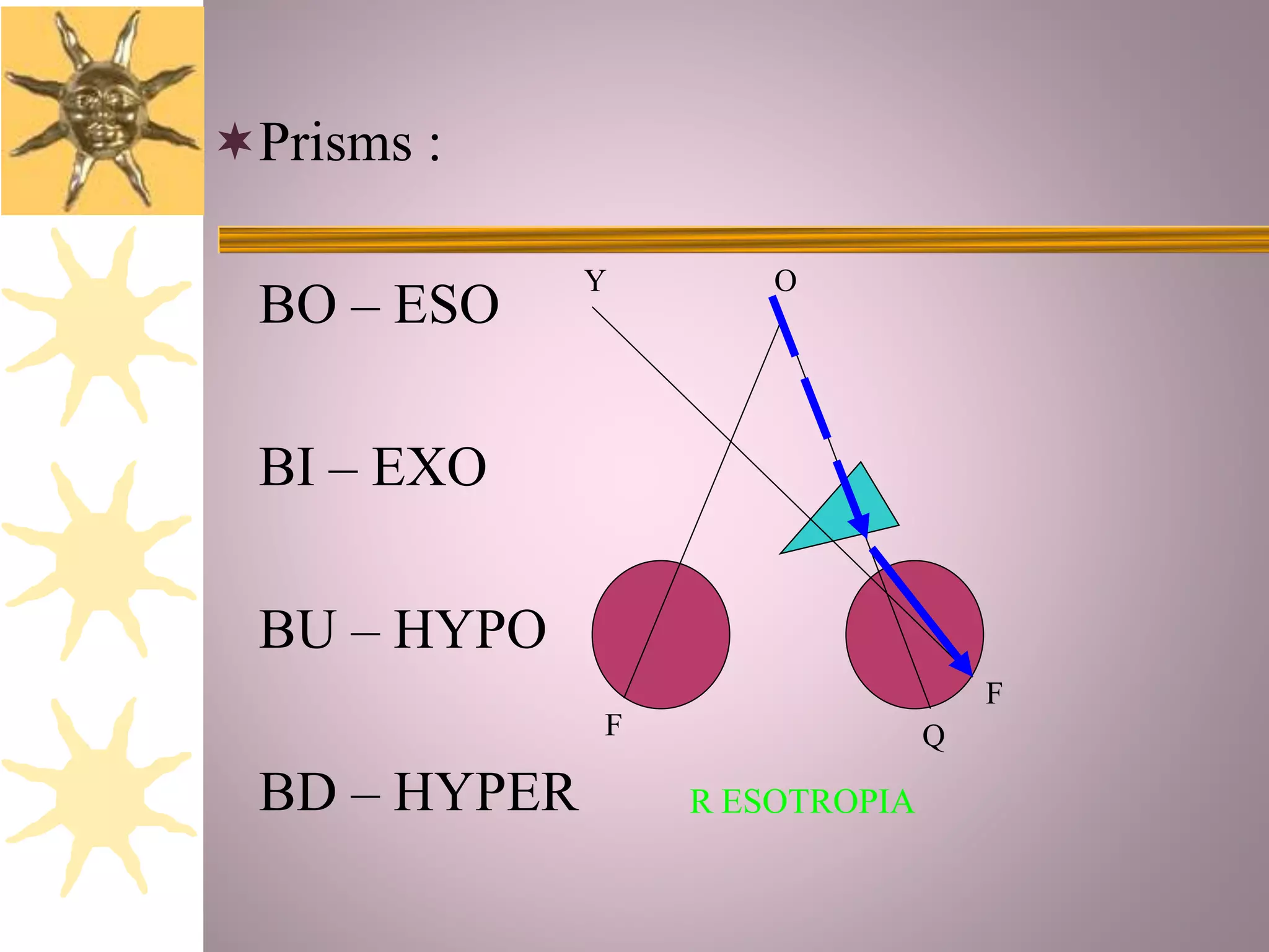 Binocular anomalies What we should know? | PPTX