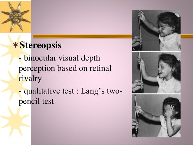 Binocular anomalies What we should know?