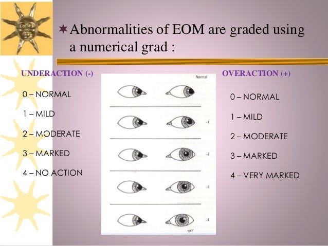 Binocular anomalies What we should know?