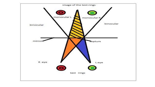 Binocular refraction techniques, binocular balancing | PPT
