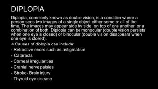 BINOCULAR SINGLE VISION.pptx mmmmmmmmmmmmmmmmmmmmmmmmmmmmmmmmmmmm | PPTX