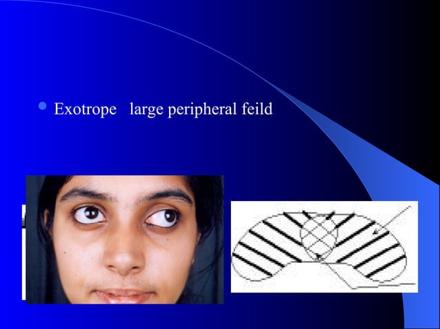 Basics of BINOCULAR SINGLE VISION.ppt
