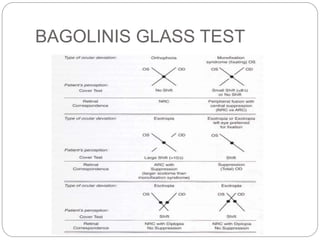 Binocular vision | PPTX