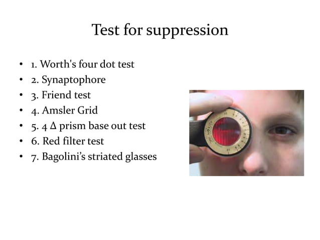 Binocular vision and stereopsis | PPTX