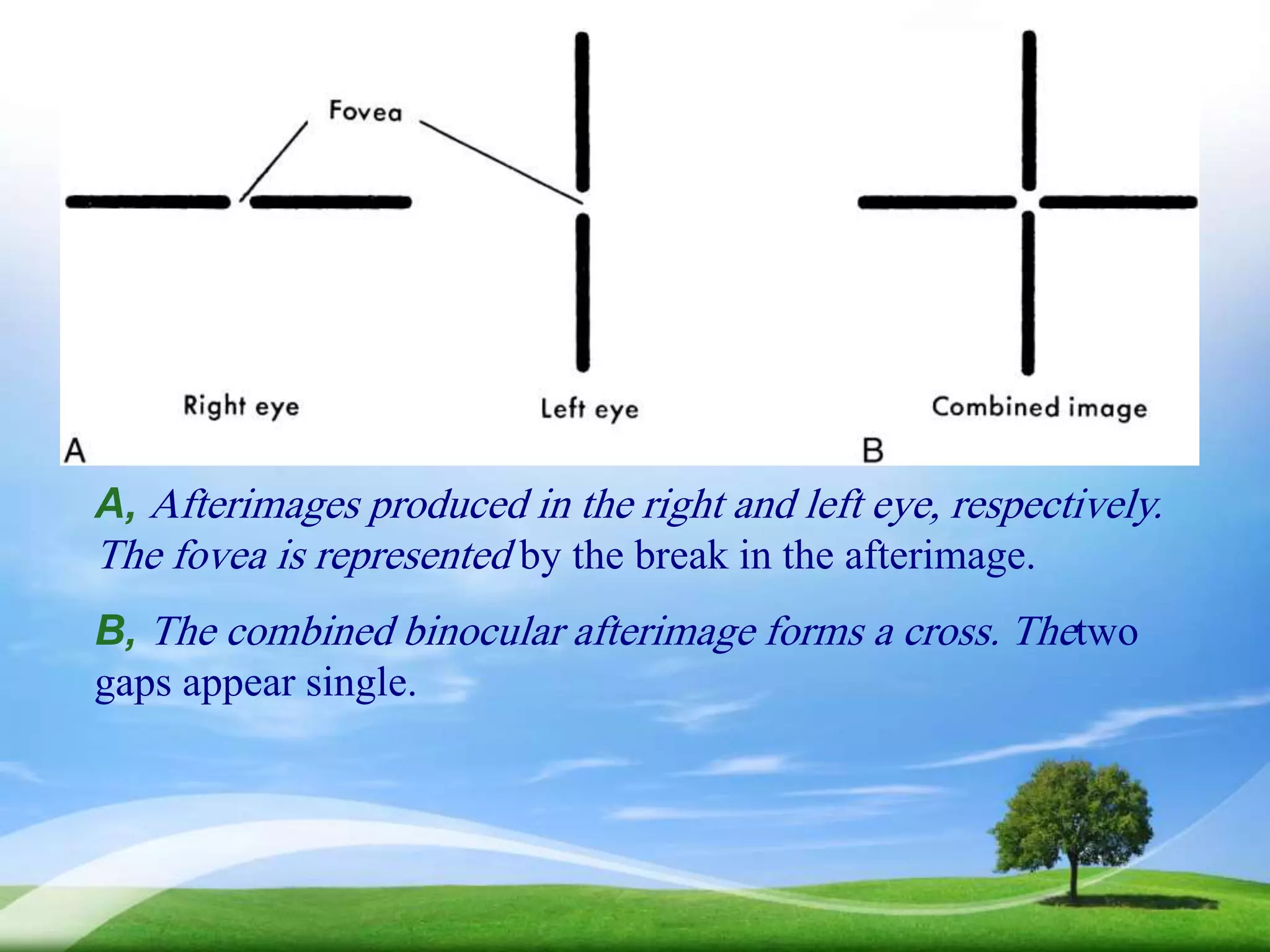 Binocular vision and vision perception | PPTX
