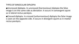 BINOCULAR VISION PowerPoint presentation.pptx | Eye and Vision ...