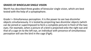 BINOCULAR VISION PowerPoint presentation.pptx | Eye and Vision ...