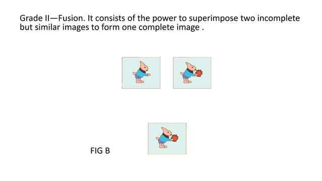 BINOCULAR VISION PowerPoint presentation.pptx | Eye and Vision ...