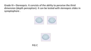 BINOCULAR VISION PowerPoint presentation.pptx | Eye and Vision ...