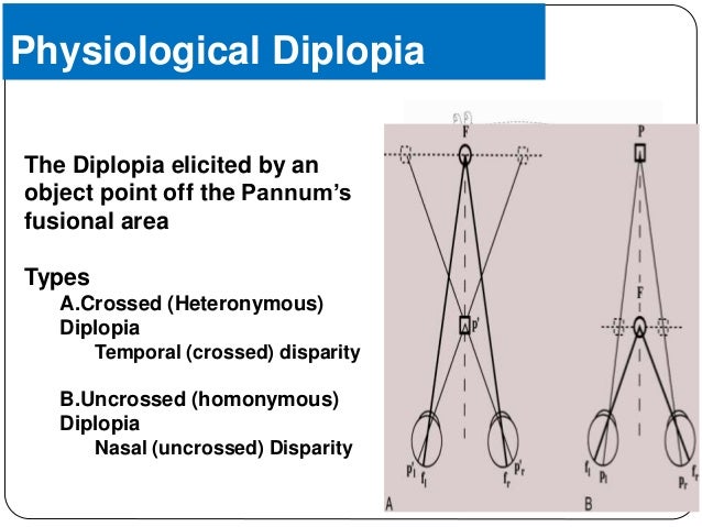 Binocular vision basics