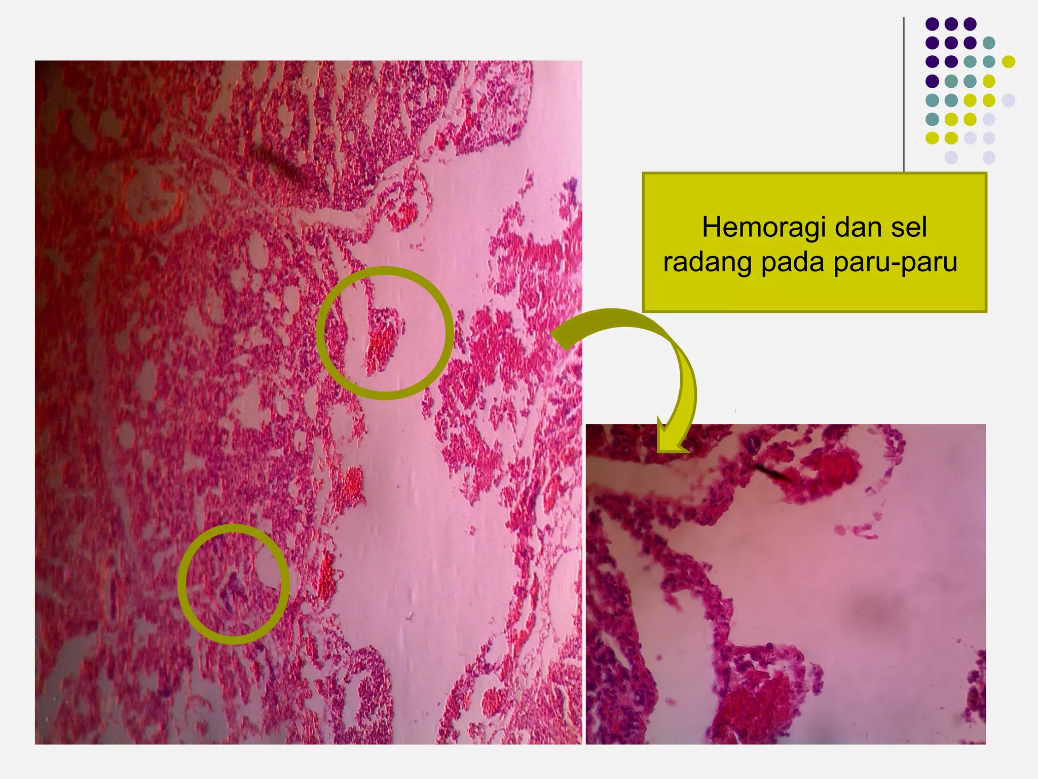 infectious bursal disease | PPT