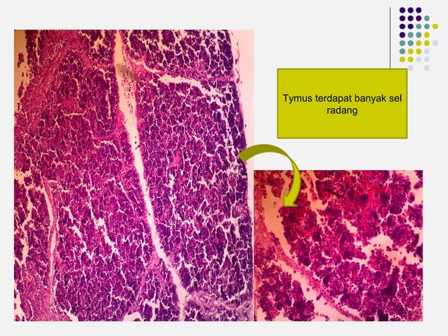 infectious bursal disease | PPT